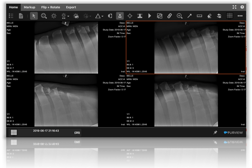 Purview Patient | Take control of ALL your family's medical images!